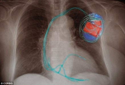 Wirelessly Charged Heart Pacemaker To Revolutionize The Biomedical ...